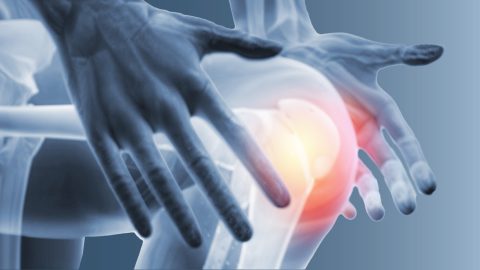 Arthrose | MedAthlon